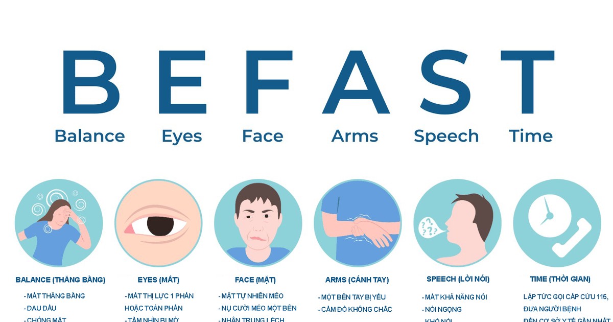 BE FAST - dấu hiệu nhận biết những triệu chứng đột quỵ | Báo điện tử An ...